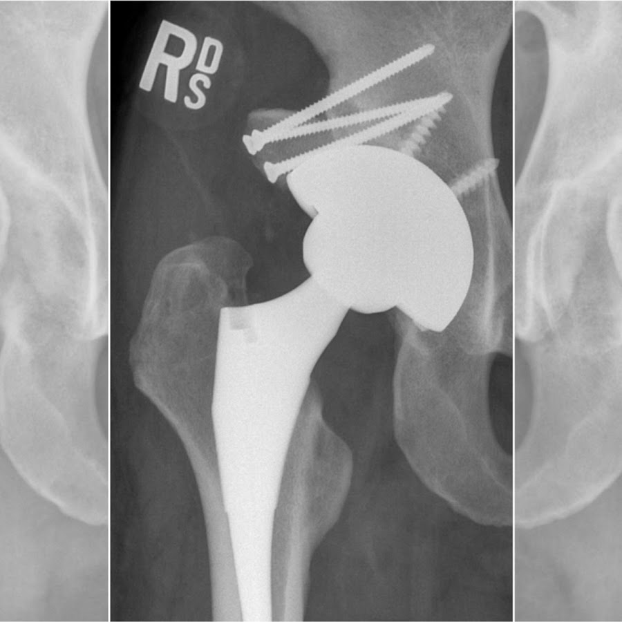 AGIKgqPy0f2ZIX7ii0ONDR_8VafaxeYYVASwHpTm4h8e=s900-c-k-c0x00ffffff-no-rj